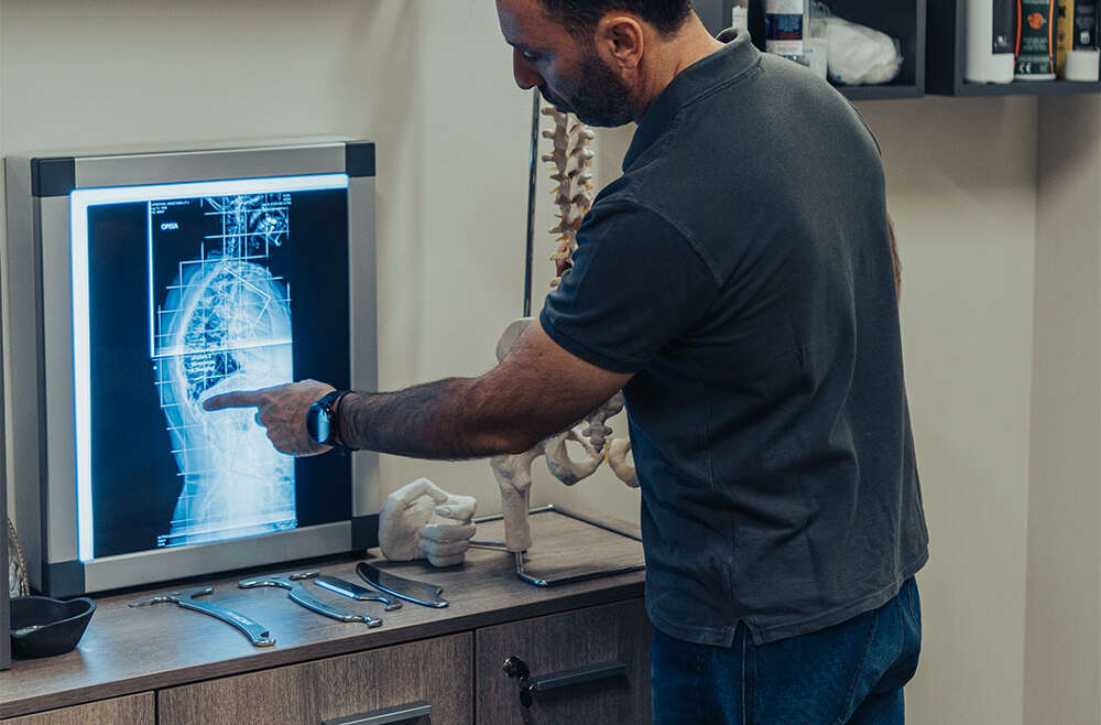 Κύφωση - Physiotherapy & Rehab
